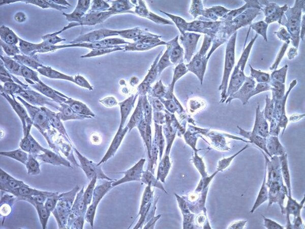 CT-2A Mouse Glioma Cell Line | SCC194